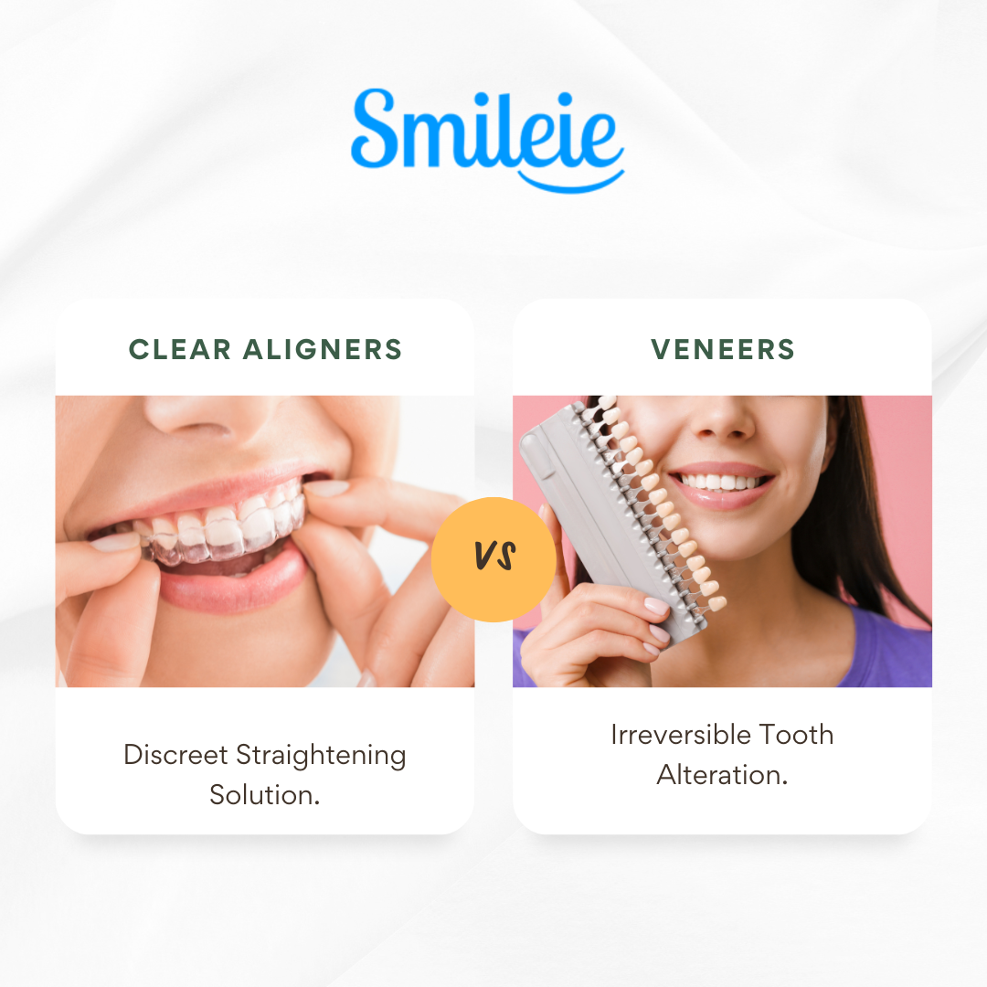 Clear Aligners vs Veneers: Which Is Right for Your Smile? Smileie UK